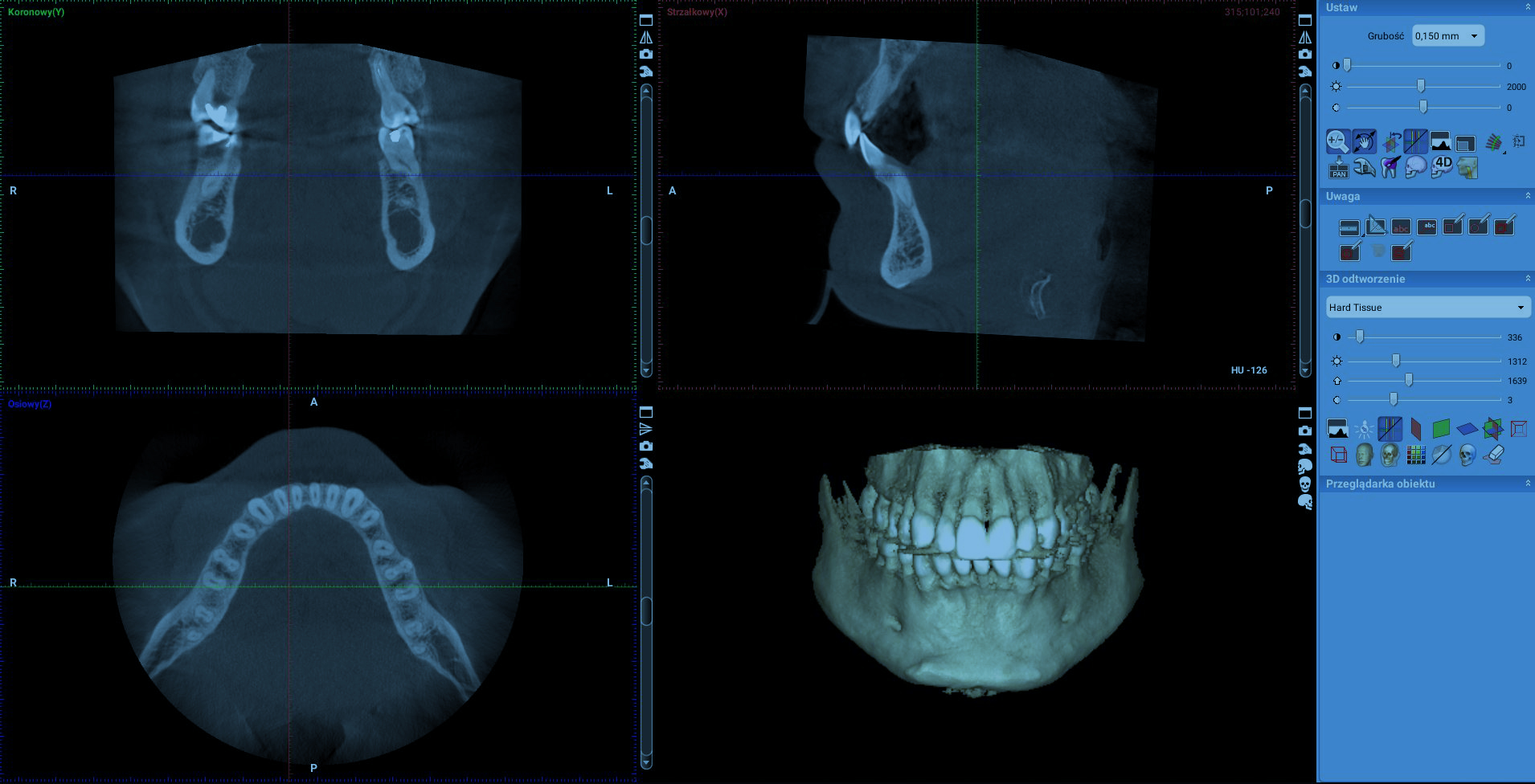 Jak wygląda badanie CBCT? Wskazania i przeciwwskazania do tomografii